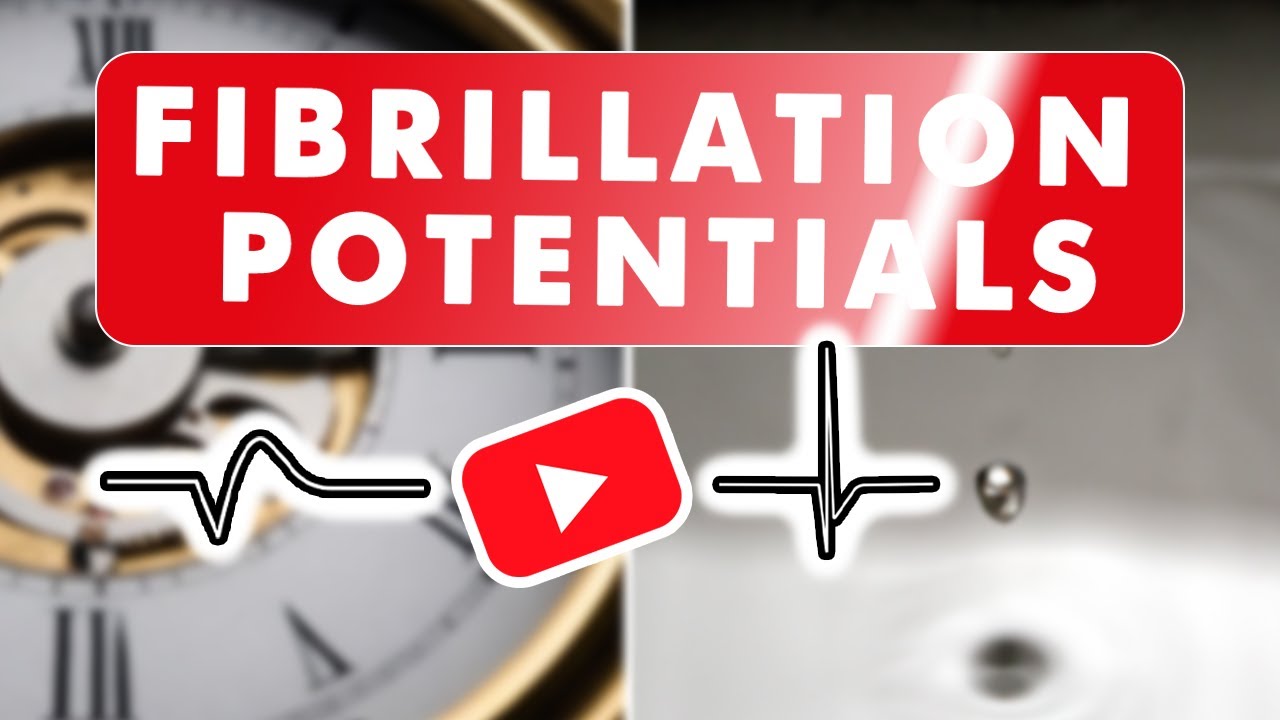 Fibrillation Potentials - YouTube