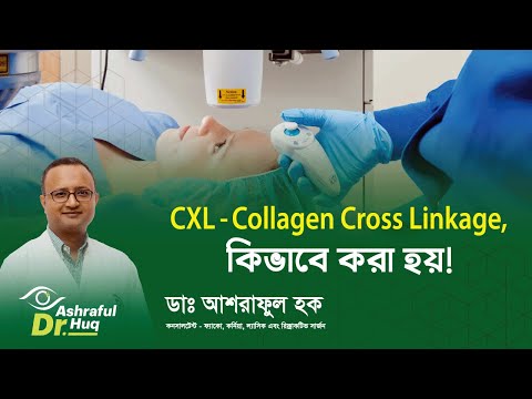 CXL - Collagen Cross Linkage, কিভাবে করা হয়! II ডাঃ আশরাফুল হক