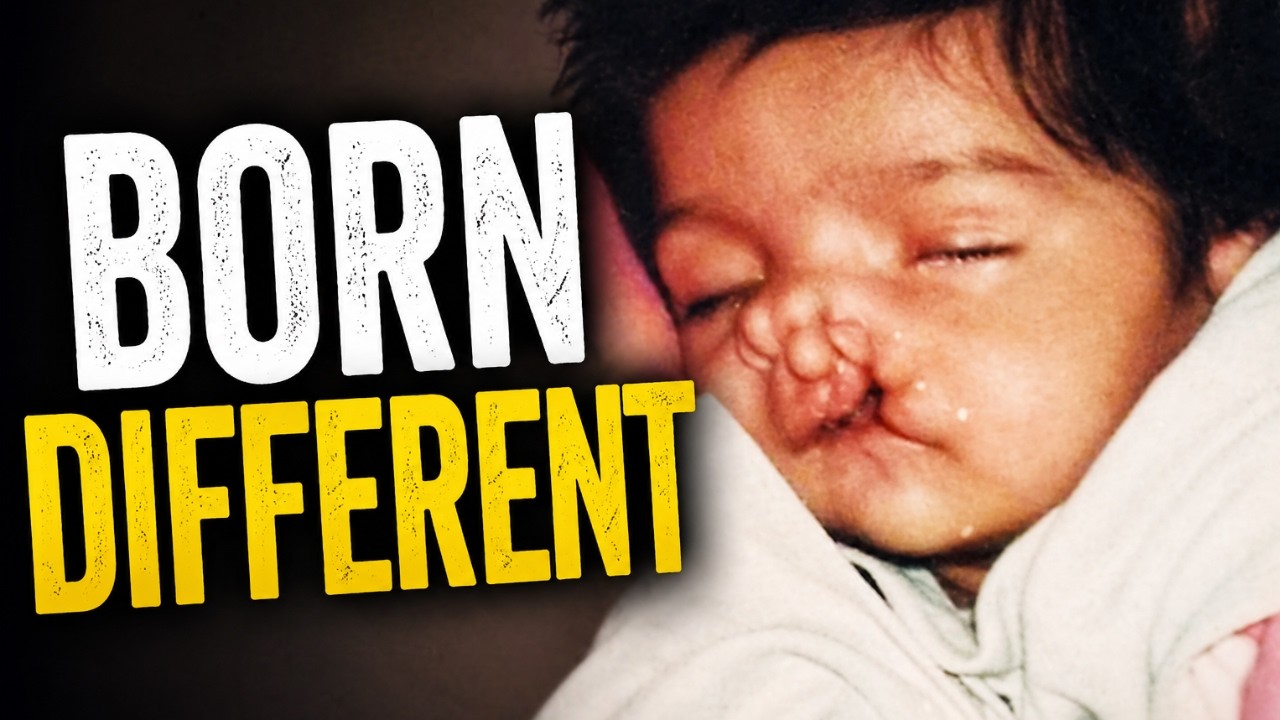Deafness & Craniofacial Syndrome Empowered Me - YouTube