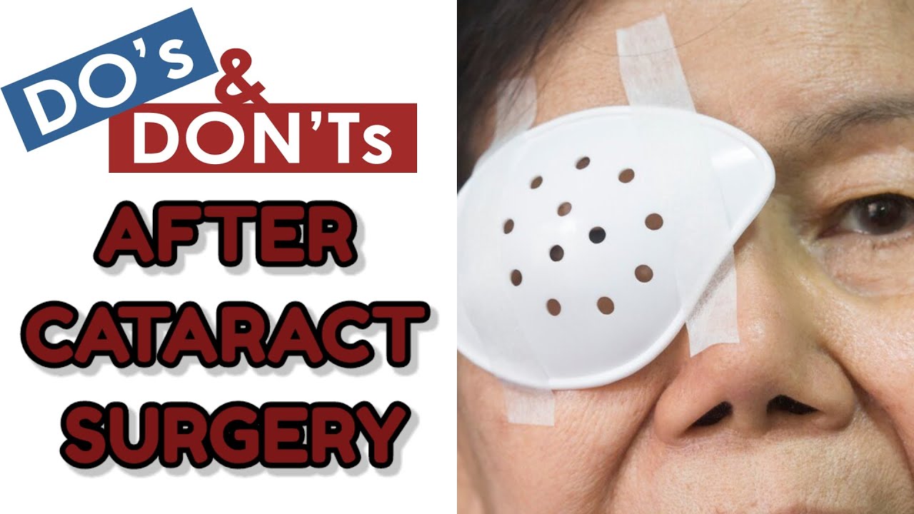 Dos And Donts After Cataract Surgery Eye Care Tips After Cataract