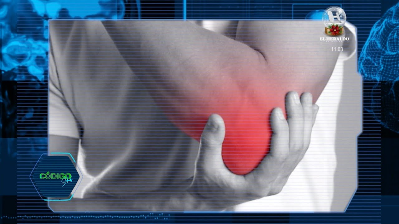 ¿Dolor en el codo? Podría tratarse de epicondilitis - YouTube