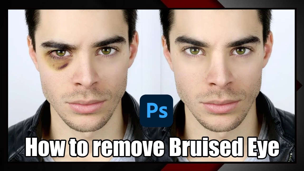 Remove eye bruise in Photoshop Easy Tutorial - YouTube