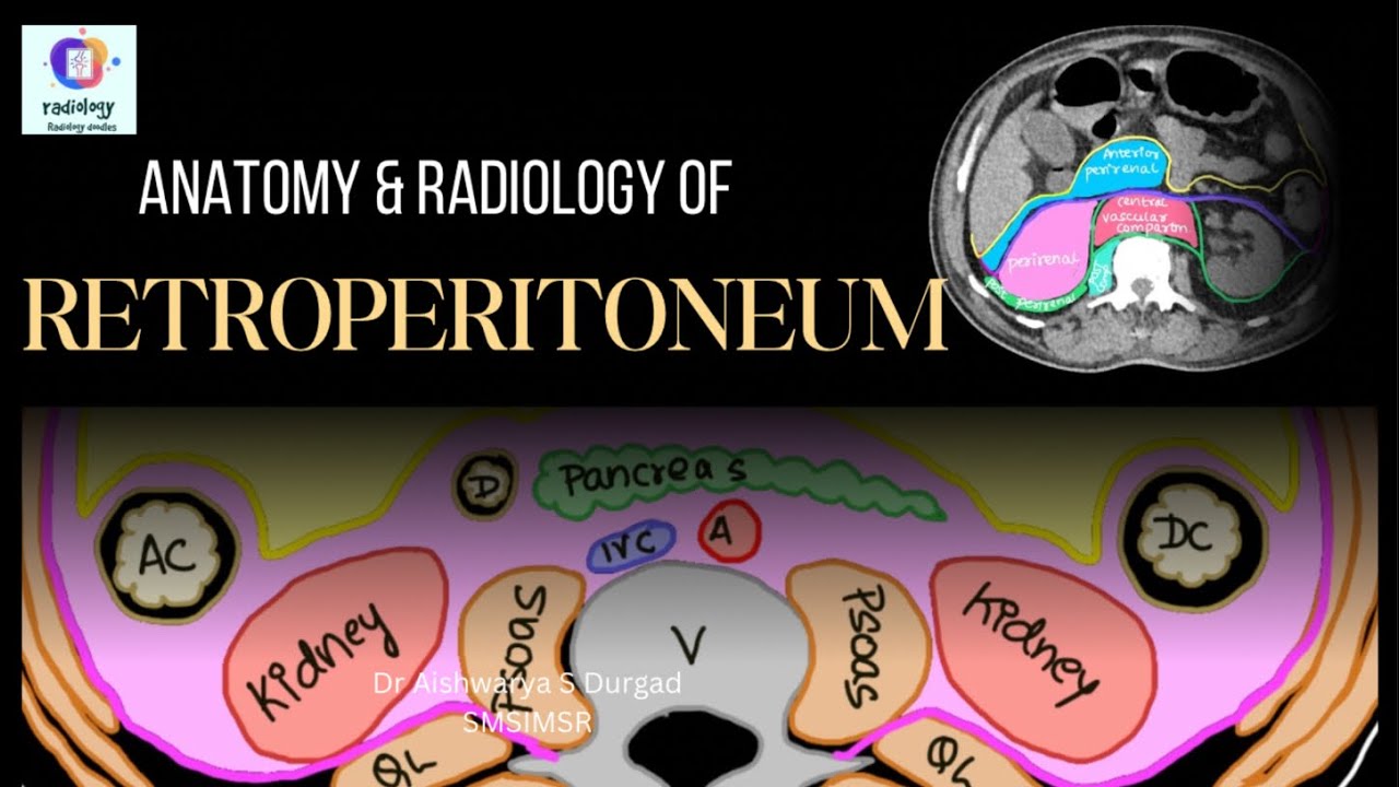 Anatomy & Radiology of RETROPERITONEUM | Contents, compartments, spaces ...
