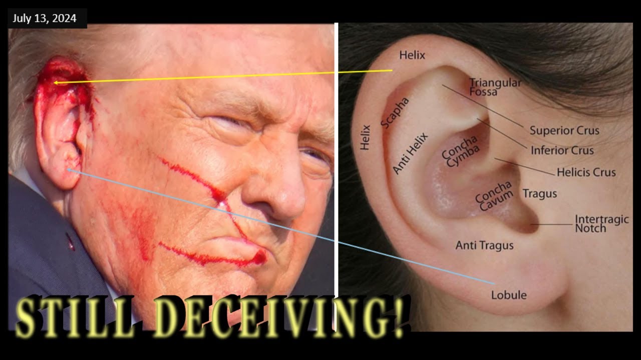 Donald Trump claims he was shot in the ear lobe - still deceiving ...