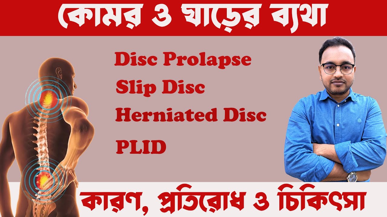 কোমর ও ঘাড়ের ব্যথা | Disc Prolapse | Slip Disc | Herniated Disc | PLID ...