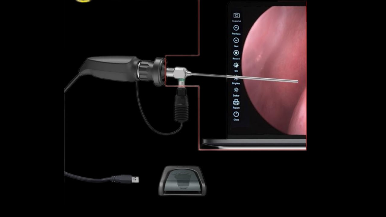 All-in-one portable ENT endoscope operation guide - YouTube