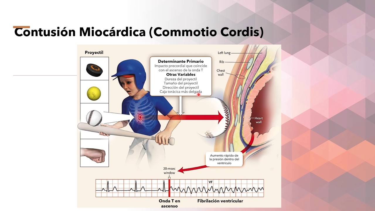 Traumatismo Cardiaco - YouTube