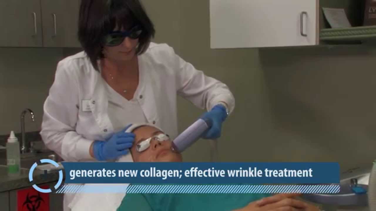 Effective Wrinkle Reduction with Matrix - YouTube
