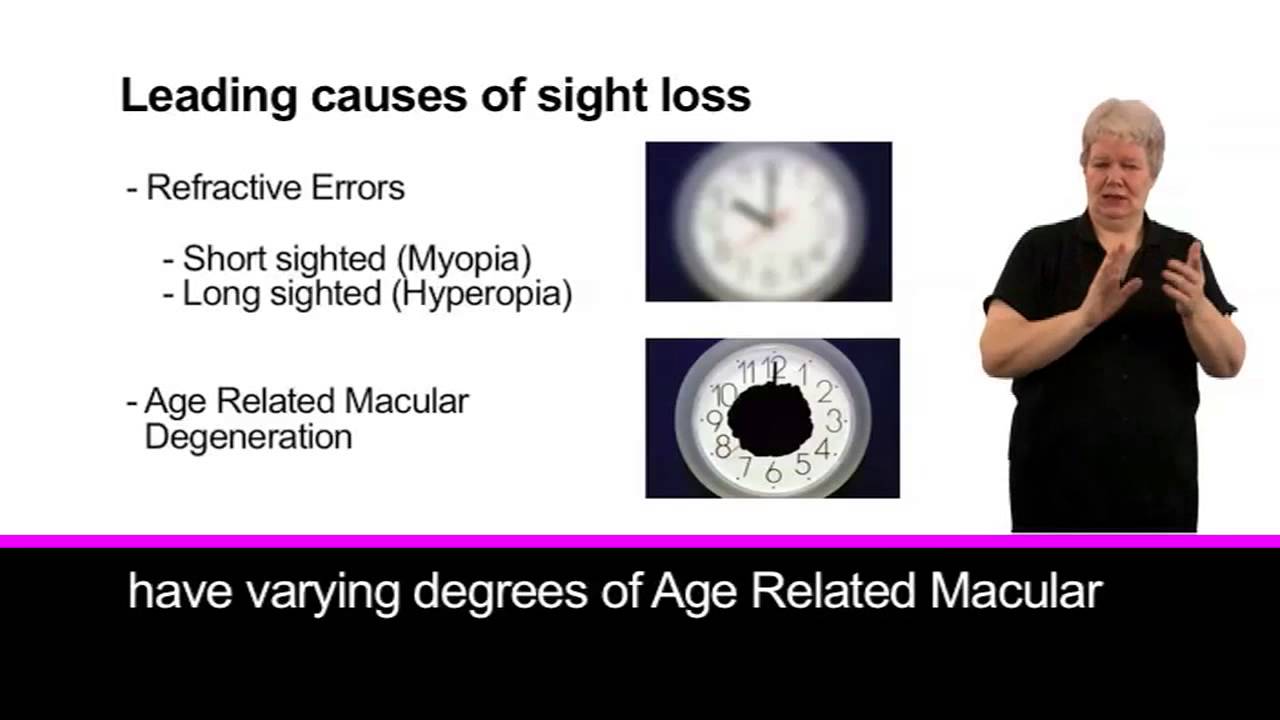 Most common age related causes of sight loss - YouTube