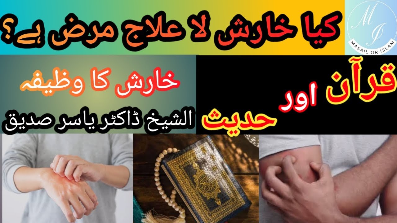Kharish Ka ilaj | Alergi Skin Care Medicine | Alergi | Masail Or Islam ...