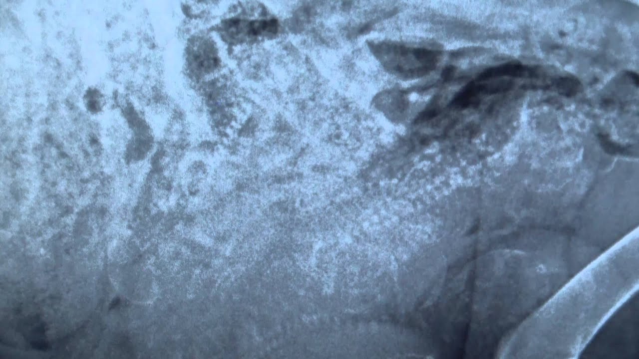 How many Great Dane Puppies on the X-Ray? - YouTube