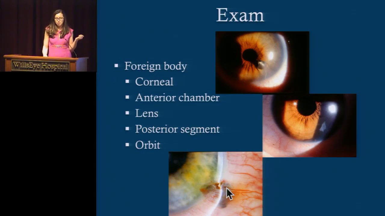 Corneal Lacerations When and How to Repair - YouTube
