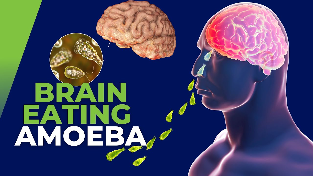 Brain-eating amoeba - Naegleria Fowleri - Symptoms, Prevention and ...