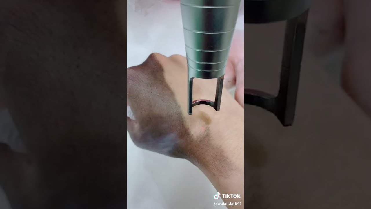 Laser carbon hand 💐💐💐💐 #short - YouTube