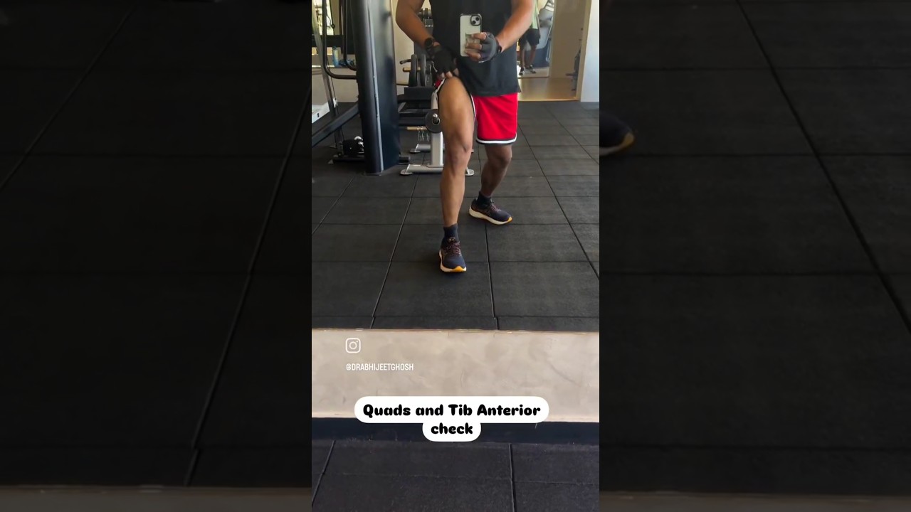Leg Check Day - YouTube