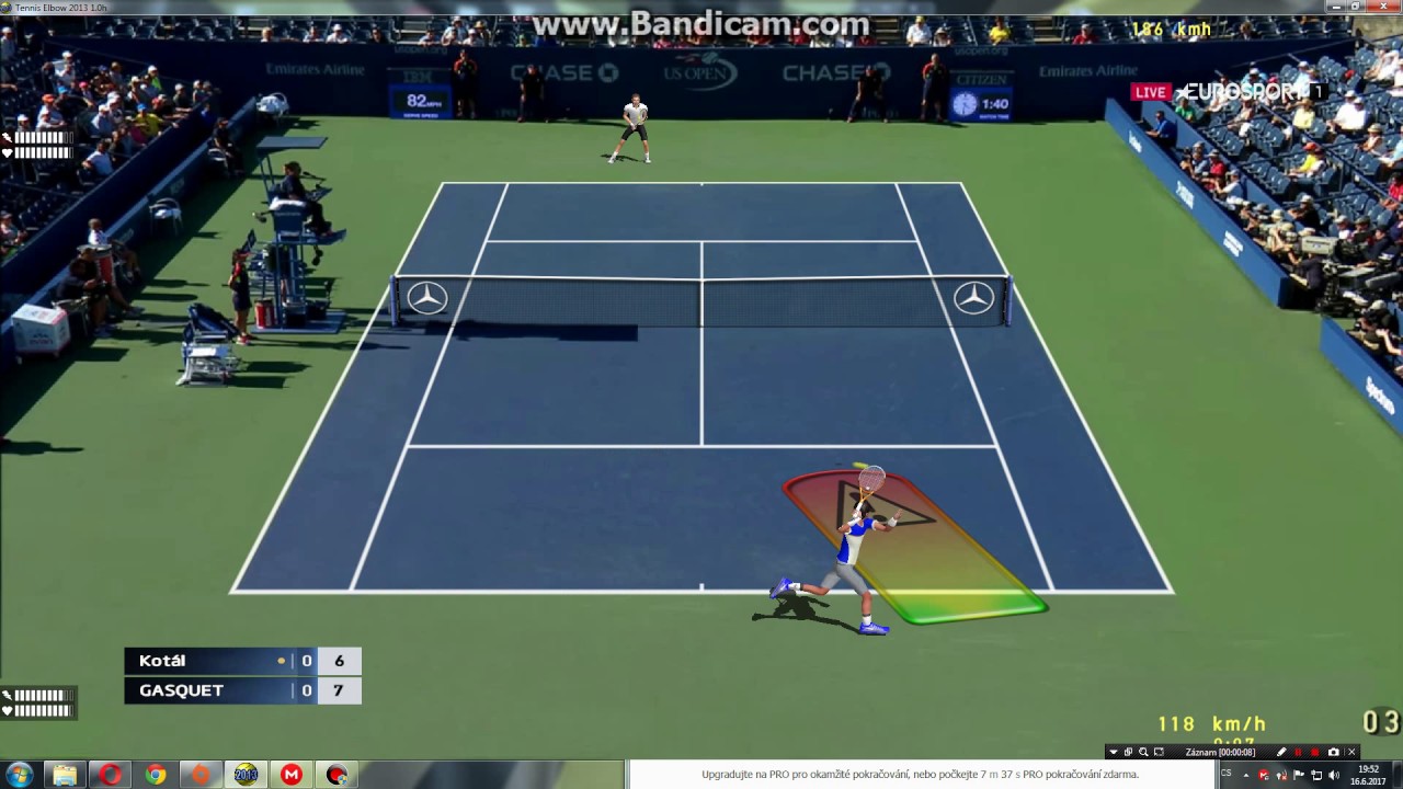 Tennis Elbow Hot Shot Us Open Youtube