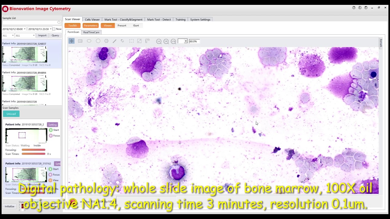 Digital pathology: whole slide image of bone marrow smear sample 1 ...