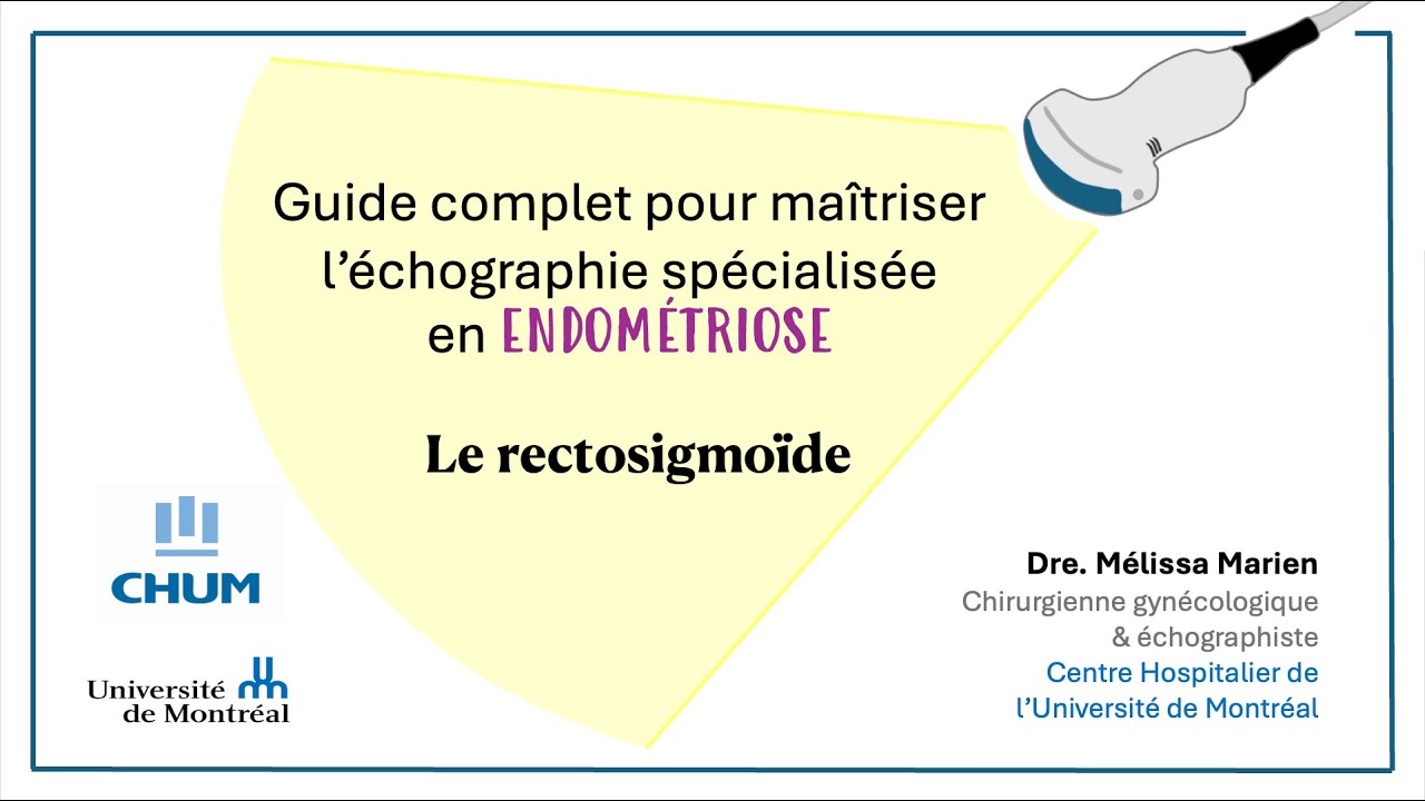 Échographie spécialisée en endométriose: Le rectosigmoïde - YouTube