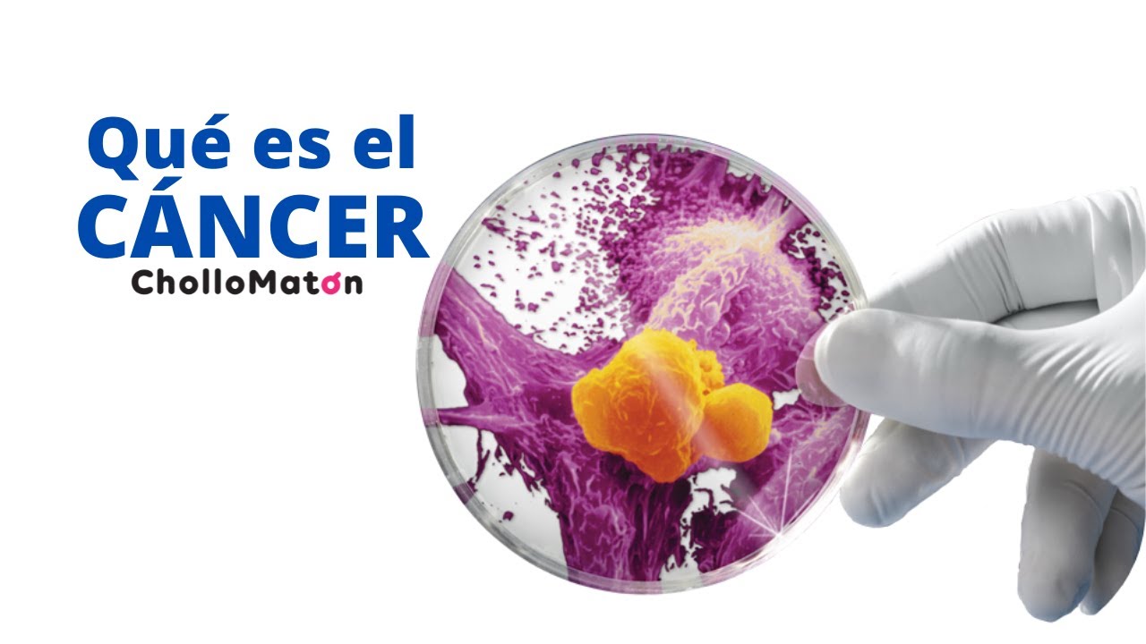 Qué es el CÁNCER. Explicación, posibles CAUSAS y síntomas que tienes ...