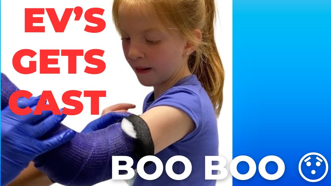 Ev’s Getting a Cast On Her Broken Arm: What To Expect and Fun Treasure ...