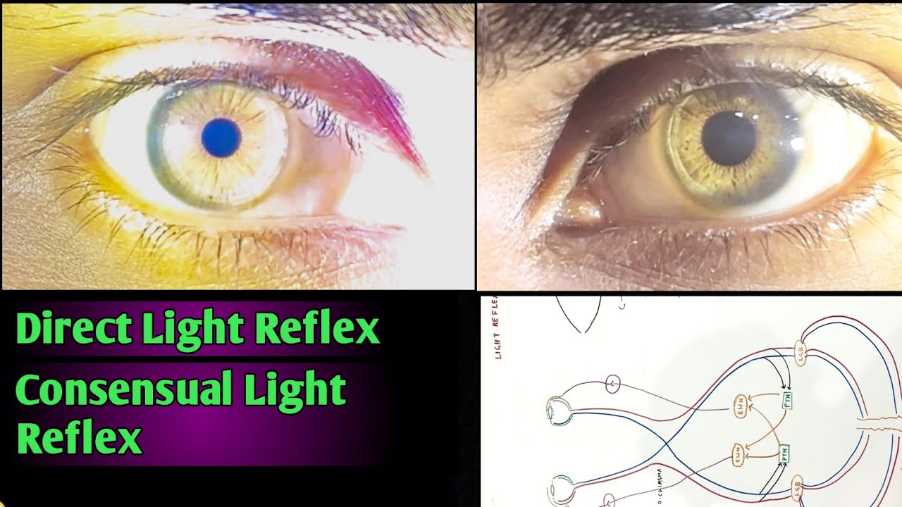 Light Reflex : Direct & Indirect. - YouTube