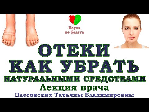 ИЗБАВЬТЕСЬ ОТ ОТЁКОВ НАВСЕГДА -||- СОВЕТЫ ВРАЧА ФИТОТЕРАПЕВТА