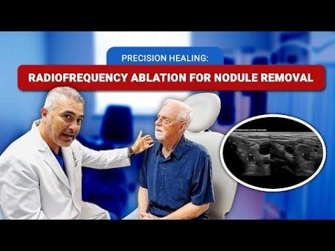 Precision Healing: Radiofrequency Ablation for Nodule Removal - YouTube