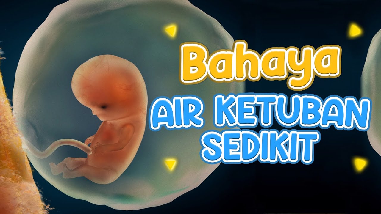 BAHAYA! Air Ketuban seidikit pada Ibu Hamil ! || Ayu Harisyah Putri - Medikacare - YouTube