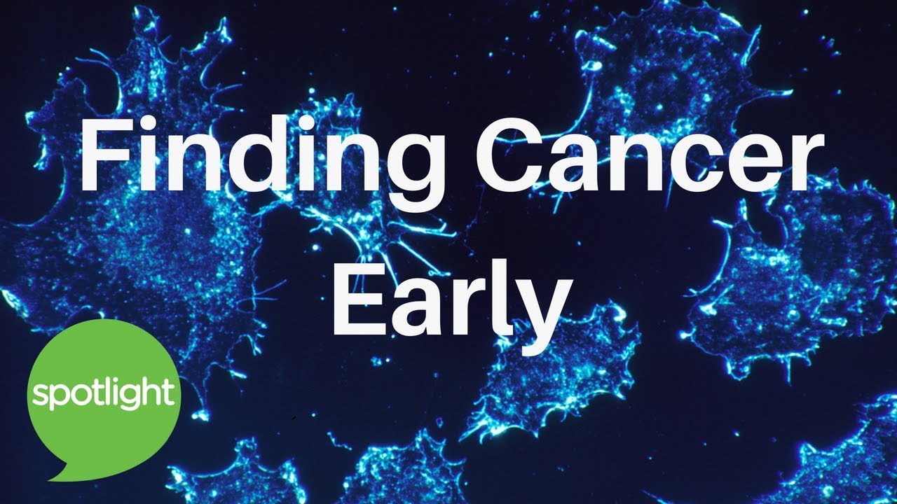 Finding Cancer Early | practice English with Spotlight - YouTube