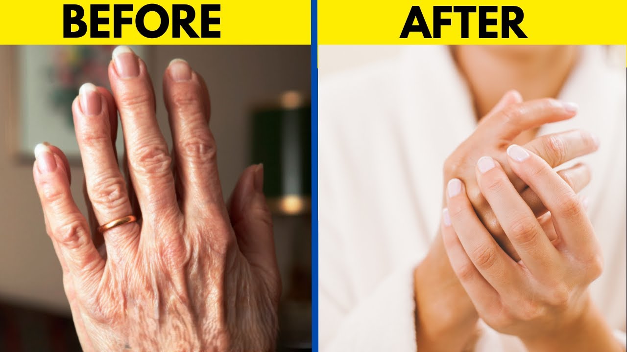 The Ultimate Hand Transformation | Best Remedy for Dryness and Wrinkles ...