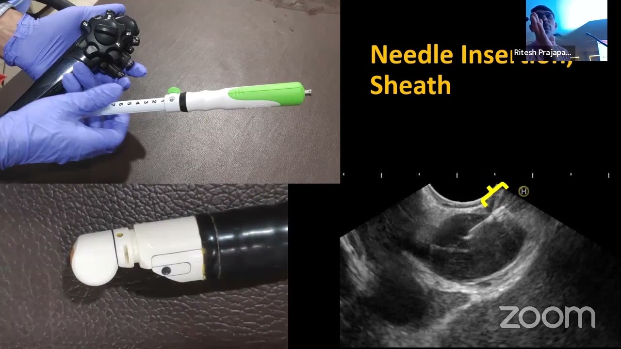 Dr Ritesh Prajapati Youtube