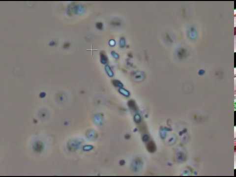Bacillus thuringiensis bipyramidal crystals - YouTube
