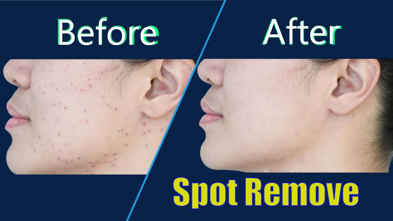 How To Remove Spot In Photoshop YouTube how-to-remove-spot-in-photoshop-youtube