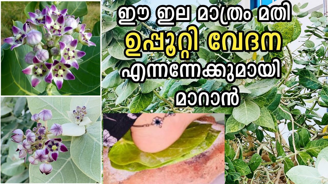 ഉപ്പൂറ്റി വേദന ,നടുവേദന ,കൈമുട്ട് വേദന ഇതെല്ലാം മാറാൻ ഇങ്ങനെ ചെയ്‌താ ...