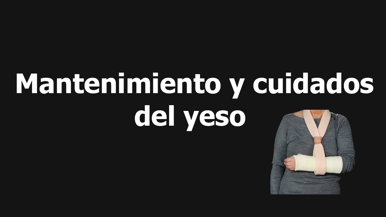 Yeso: Mantenimiento y cuidados del yeso - YouTube