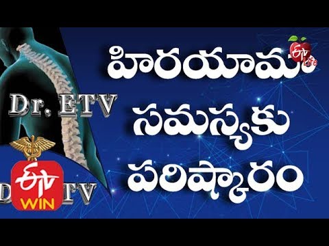 Hirayama Disease | Monomelic Amyotrophy | Hirayama Disease Treatment | Hirayama Syndrome