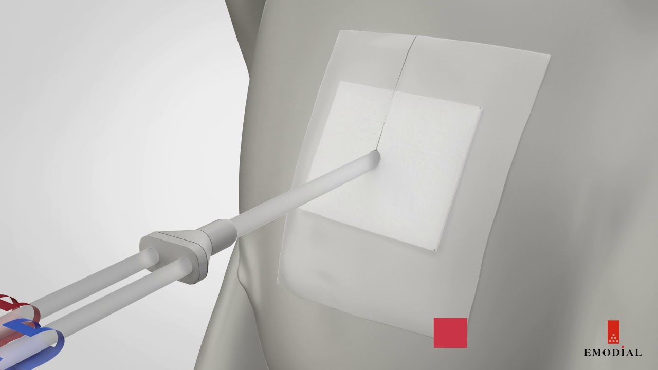 Video tutorial per Exit Pocket WP - Dispositivo medico per Emodial ...