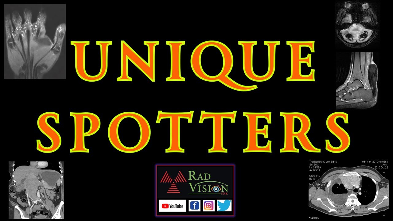 UNIQUE SPOTTERS - YouTube