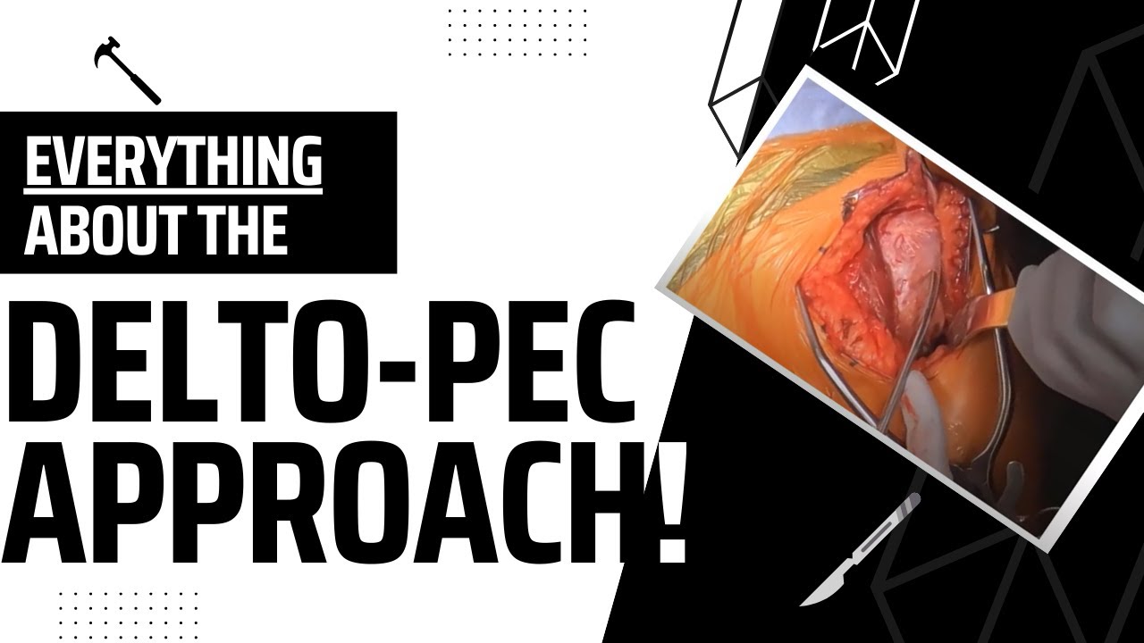DeltoPectoral Surgical Approach EXPLAINED w/ Dr. Grant Garrigues - YouTube