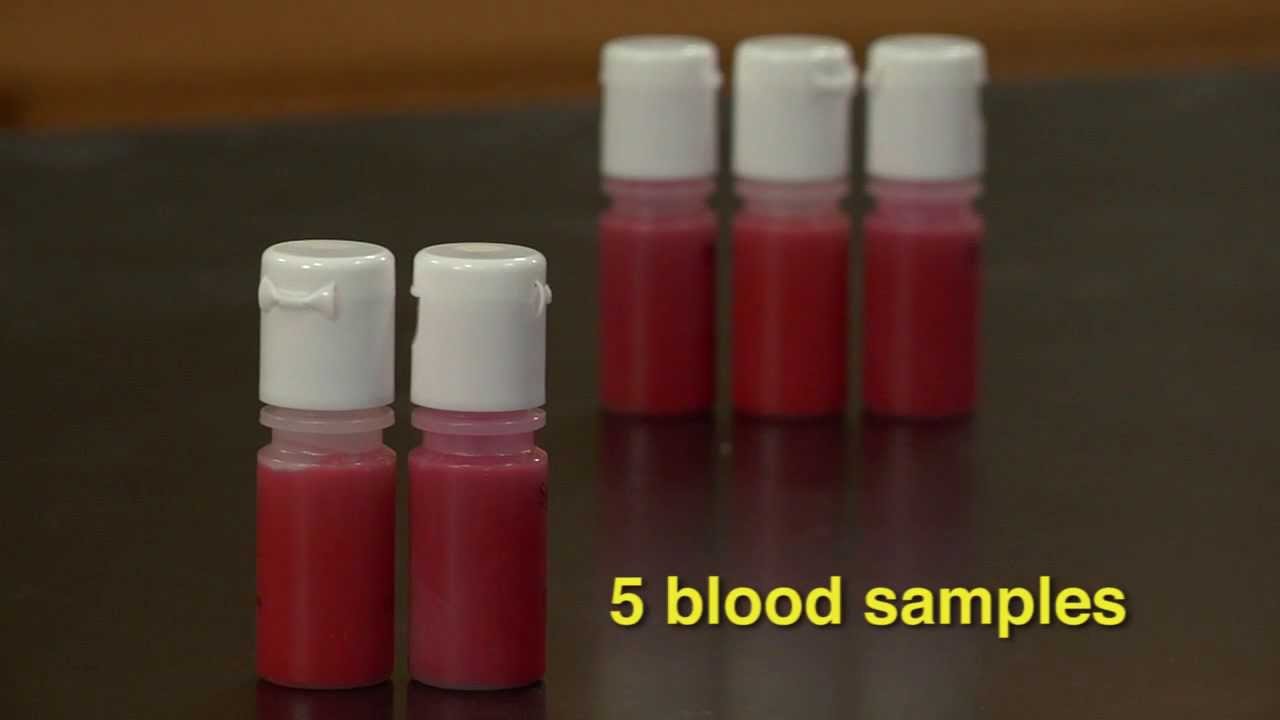 Blood Typing Exercise - YouTube