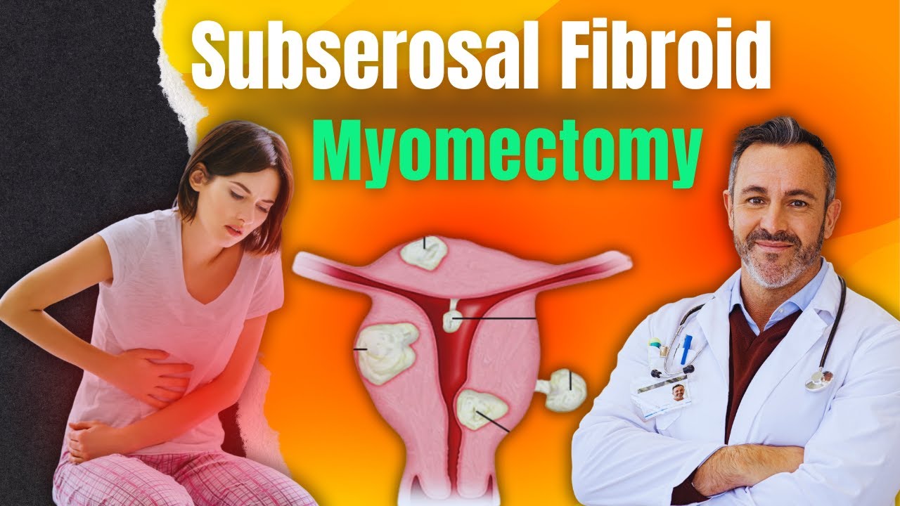 Lap Myomectomy #Subserosal Fibroid #ipd No 1122635 Dr. Gyanendra Man ...