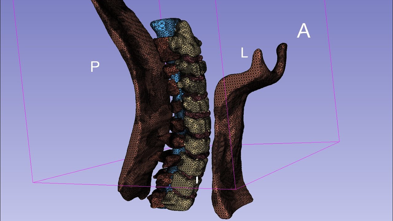 MSc Biomedical Engineering Thesis | Spinal Cord Stimulation Using Computational Model MRI ...