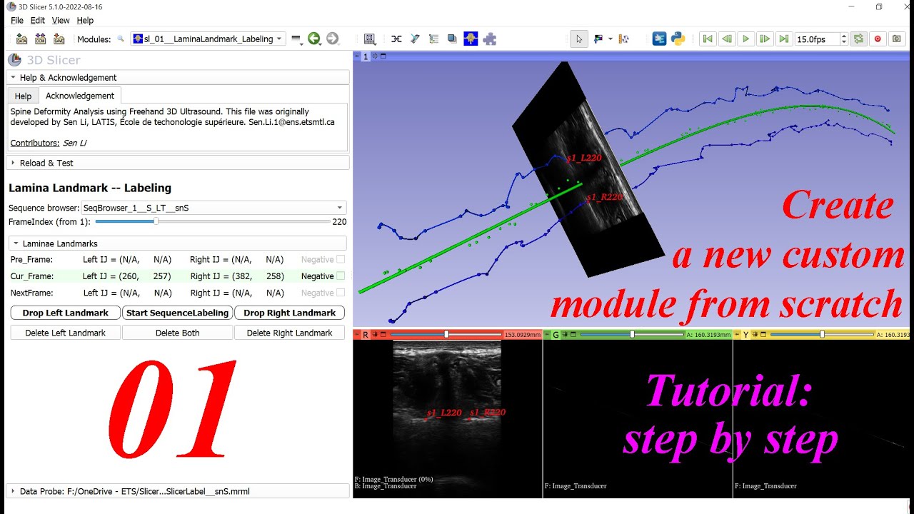 How To Create A New Custom Module Develop 3d Slicer Extension Tutorial 01 Youtube