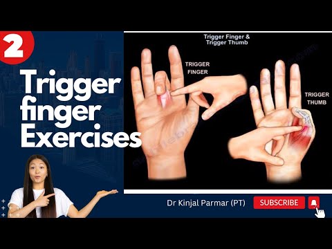 TRIGGER FINGER EXERCISES || Finger pain treatment #thumb ...