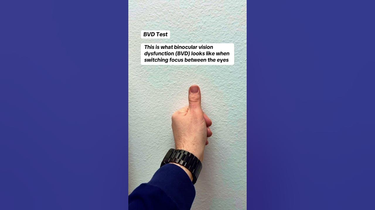 This is what binocular vision dysfunction (BVD) can look like when switching focus between the ...