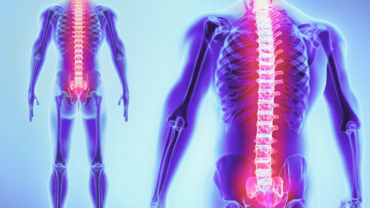 📏Back Pain Relief Subliminal : Perfect Spine Alignment and Vertebrae ...