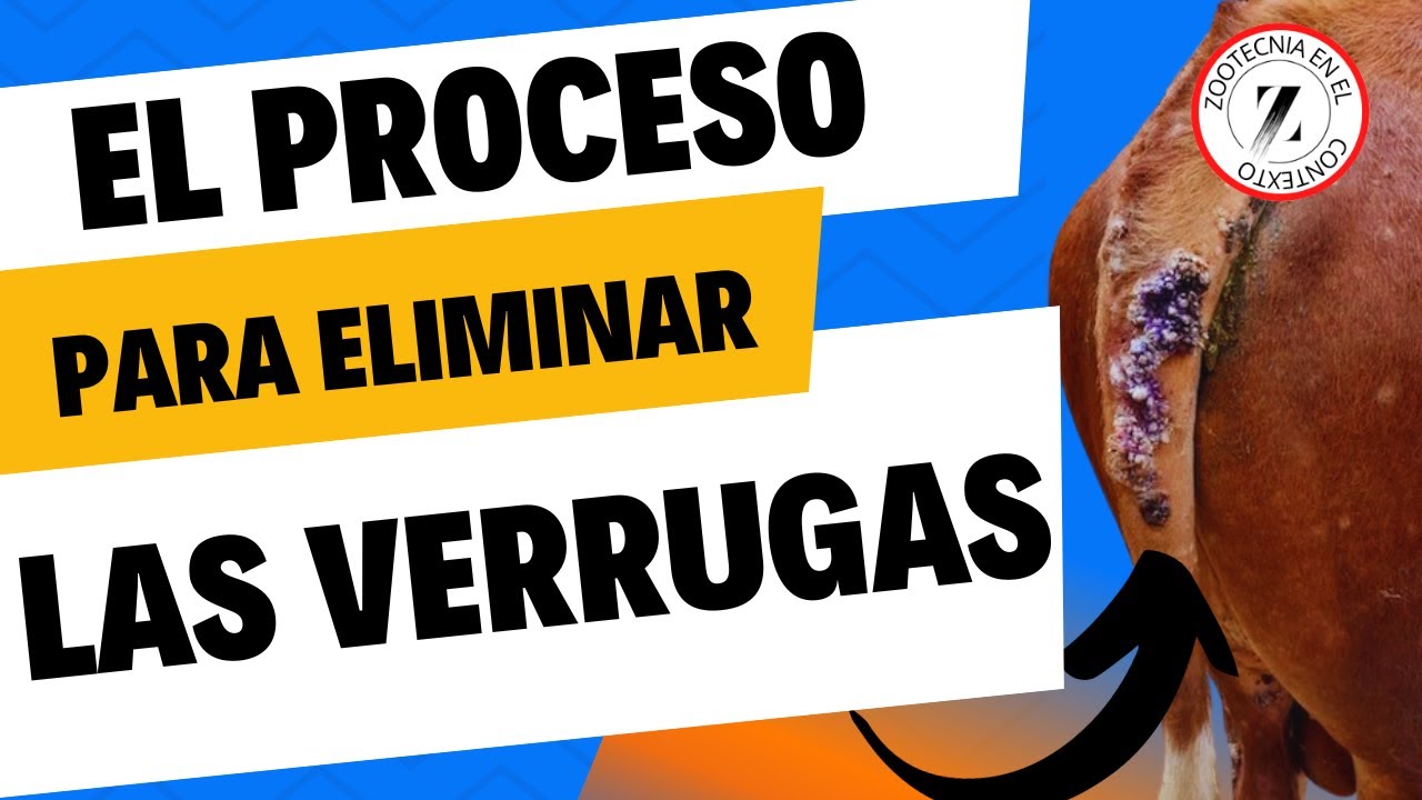 🥇¿Cual es el Tratamiento para ELIMINAR las VERRUGAS o PAPILOMATOSIS en ...