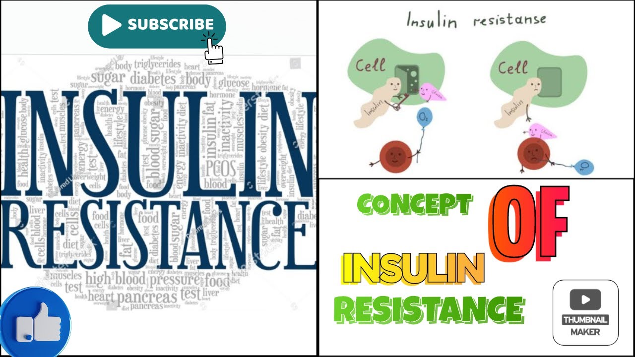 Insulin resistance|| very easy to understand|| Diabetes mellitus|| DM-4 ...