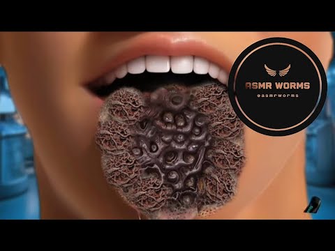 ASMR Animation Maggot Removal & Tongue Healing | No Talking | asmr worms - YouTube