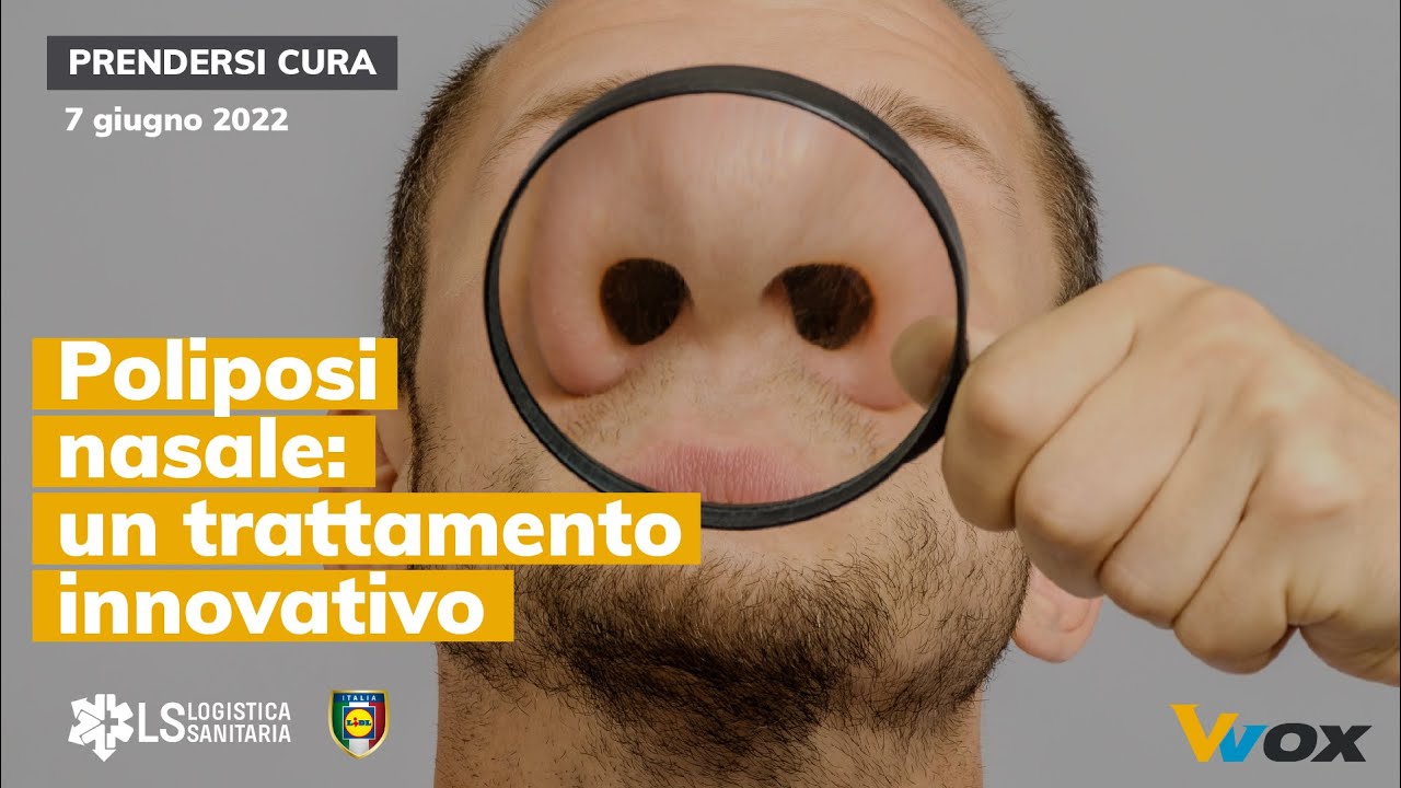 POLIPOSI NASALE: UN TRATTAMENTO INNOVATIVO - YouTube